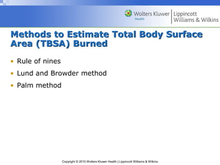 Burns.ppt
