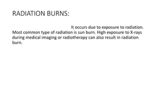 BURNS - very basic presentation for idea | PPTX