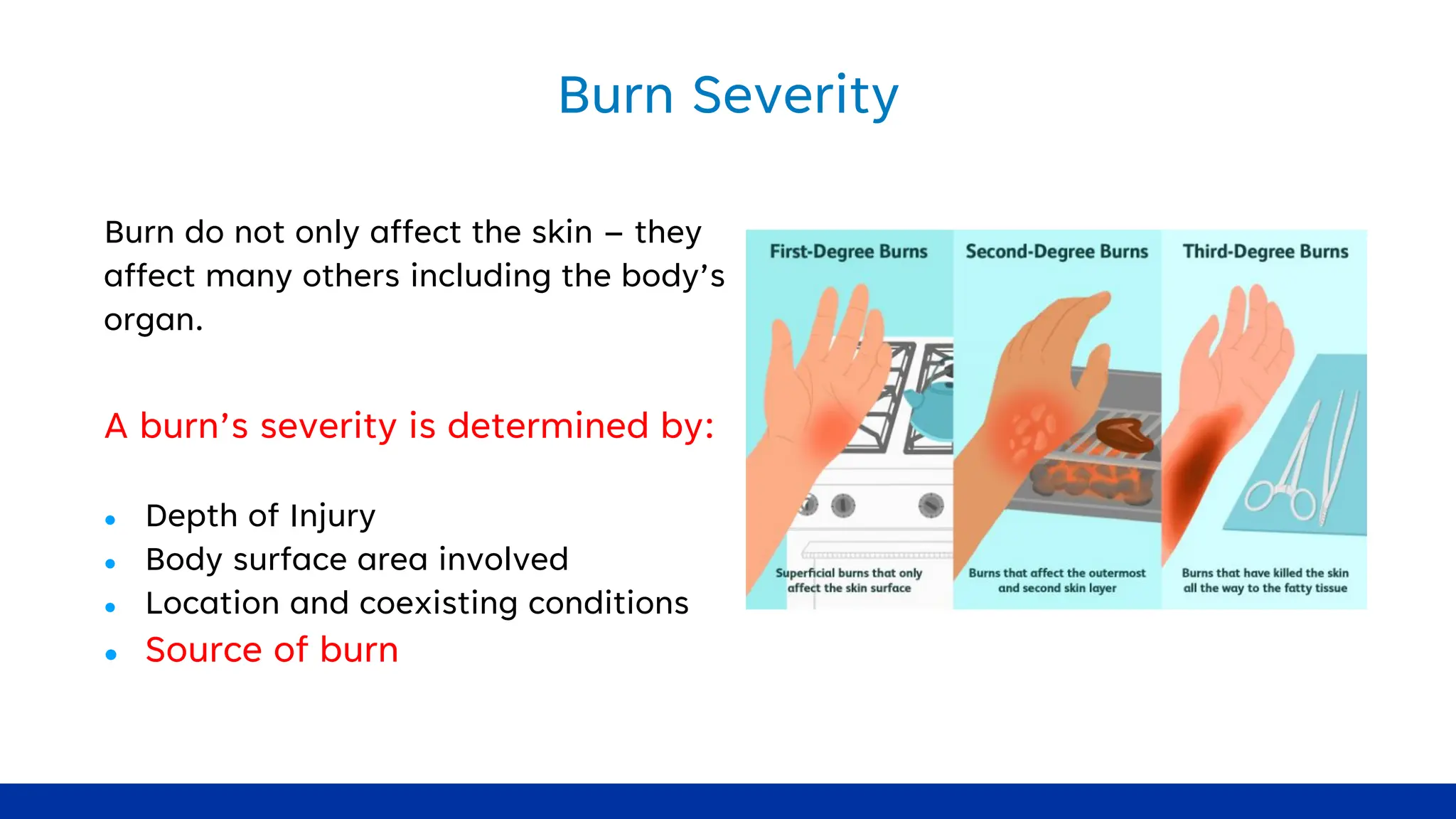 A Guide to First Aid for Burns which include the types of burns and the ...