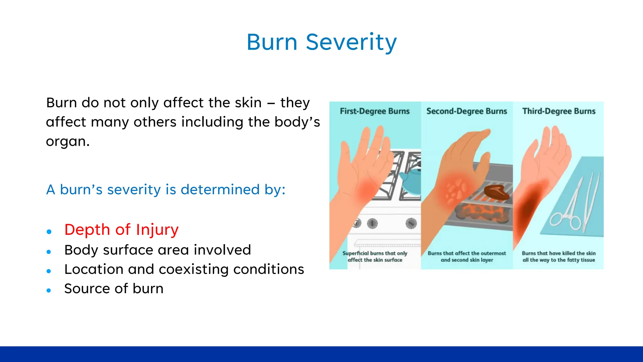 A Guide to First Aid for Burns which include the types of burns and the ...