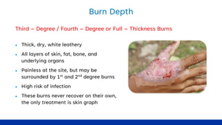 A Guide to First Aid for Burns which include the types of burns and the ...