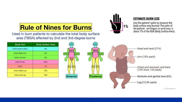 A Guide to First Aid for Burns which include the types of burns and the ...