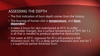 burns management and burns etiology of burns | PPTX