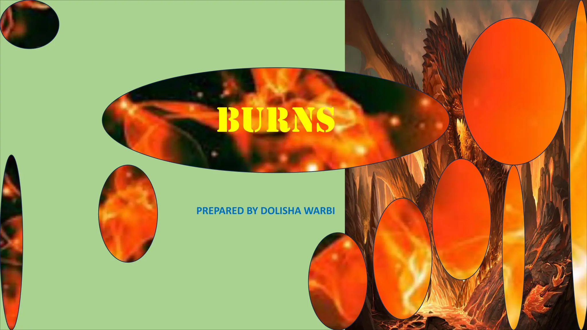 BURNS, CALCULATION OF BURNS, CALCULATION OF FLUID REQUIREMENT AND ...