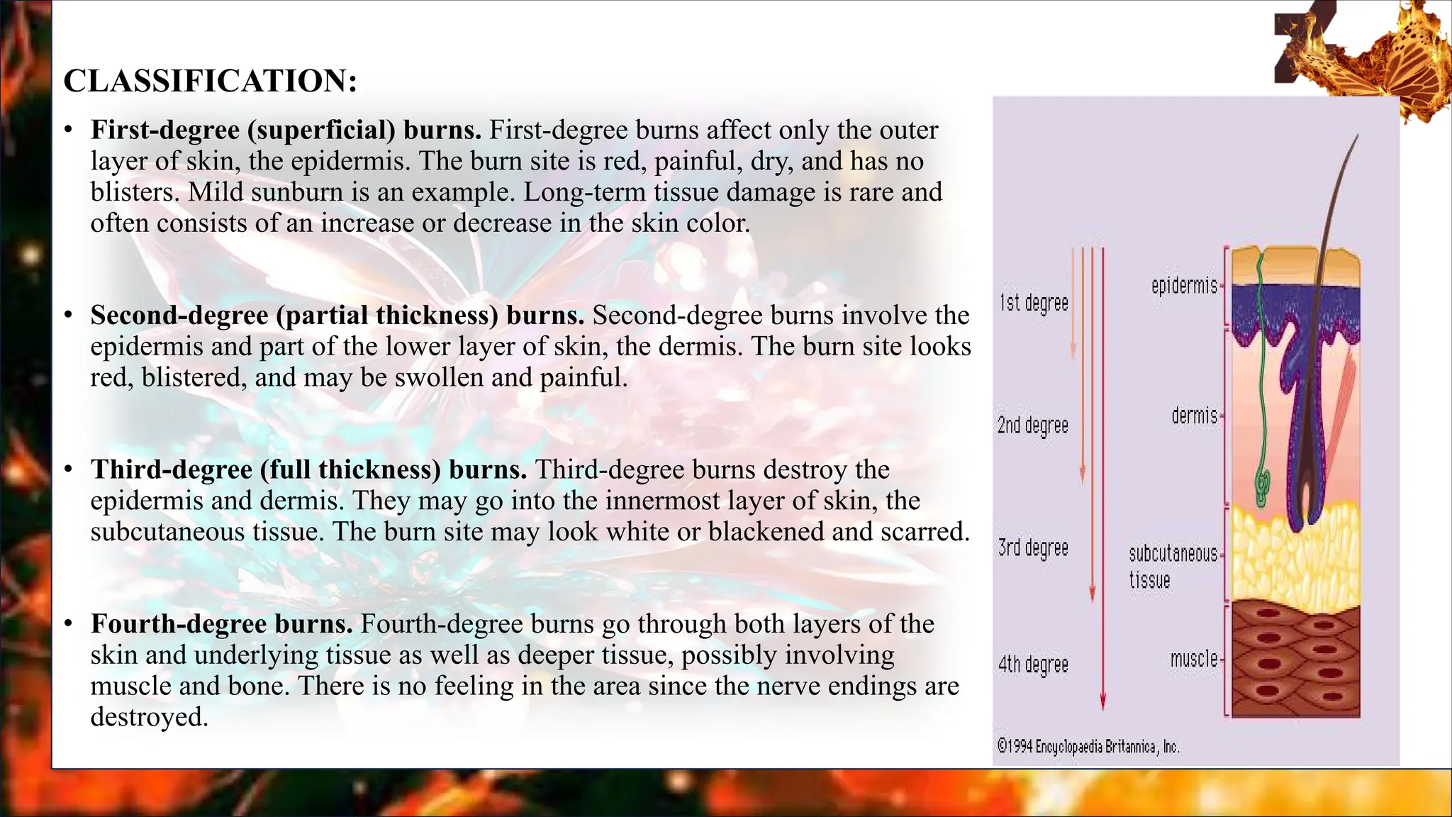 BURNS, CALCULATION OF BURNS, CALCULATION OF FLUID REQUIREMENT AND ...