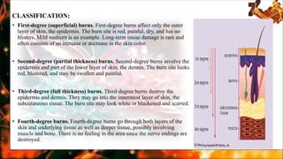 BURNS, CALCULATION OF BURNS, CALCULATION OF FLUID REQUIREMENT AND ...