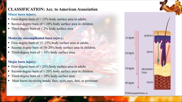 BURNS, CALCULATION OF BURNS, CALCULATION OF FLUID REQUIREMENT AND ...