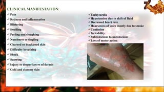 BURNS, CALCULATION OF BURNS, CALCULATION OF FLUID REQUIREMENT AND ...