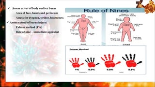BURNS, CALCULATION OF BURNS, CALCULATION OF FLUID REQUIREMENT AND ...