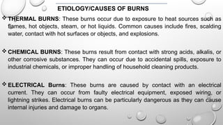 Burns.pptx2334454333454344433334333333333 | PPTX