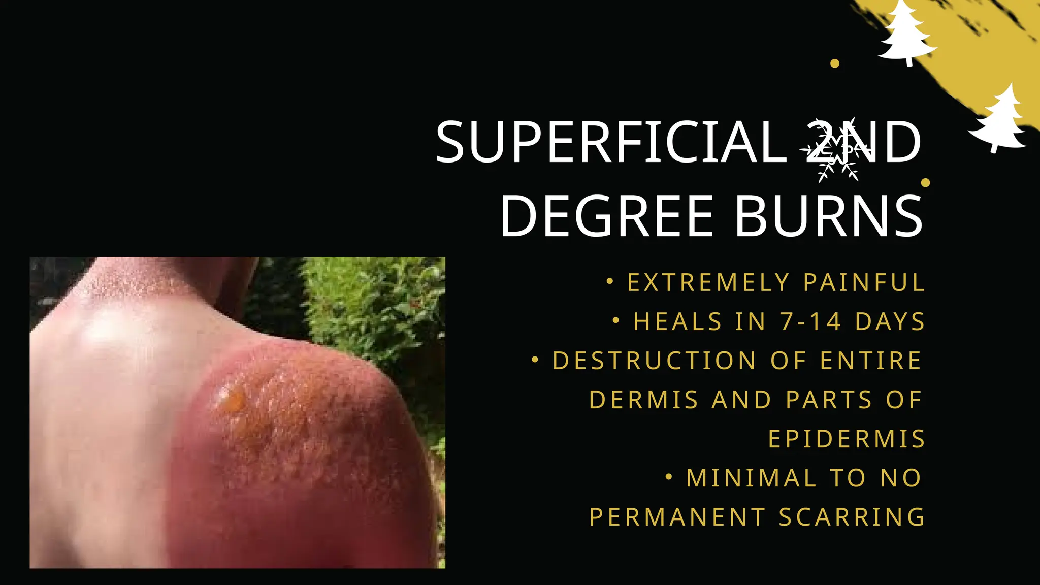 Burns Classification and Evaluation.pptx