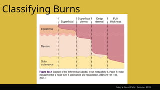Burns Classification and Evaluation.pptx