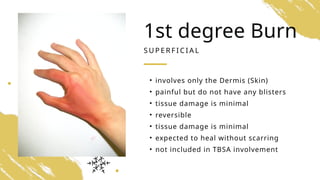 Burns Classification and Evaluation.pptx