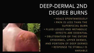 Burns Classification and Evaluation.pptx