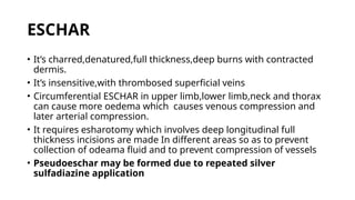 Burns classification management and complications | PPTX