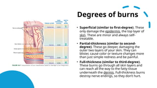 Burns: Nutritional Support and Clinical Approaches | PPTX