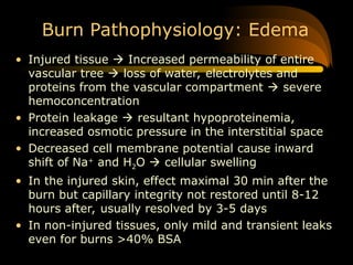 BURNS.ppt BURNS.ppt BURNS.pptBURNS.ppt BURNS.ppt