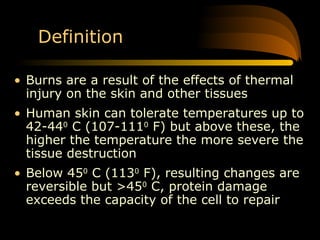 BURNS.ppt BURNS.ppt BURNS.pptBURNS.ppt BURNS.ppt