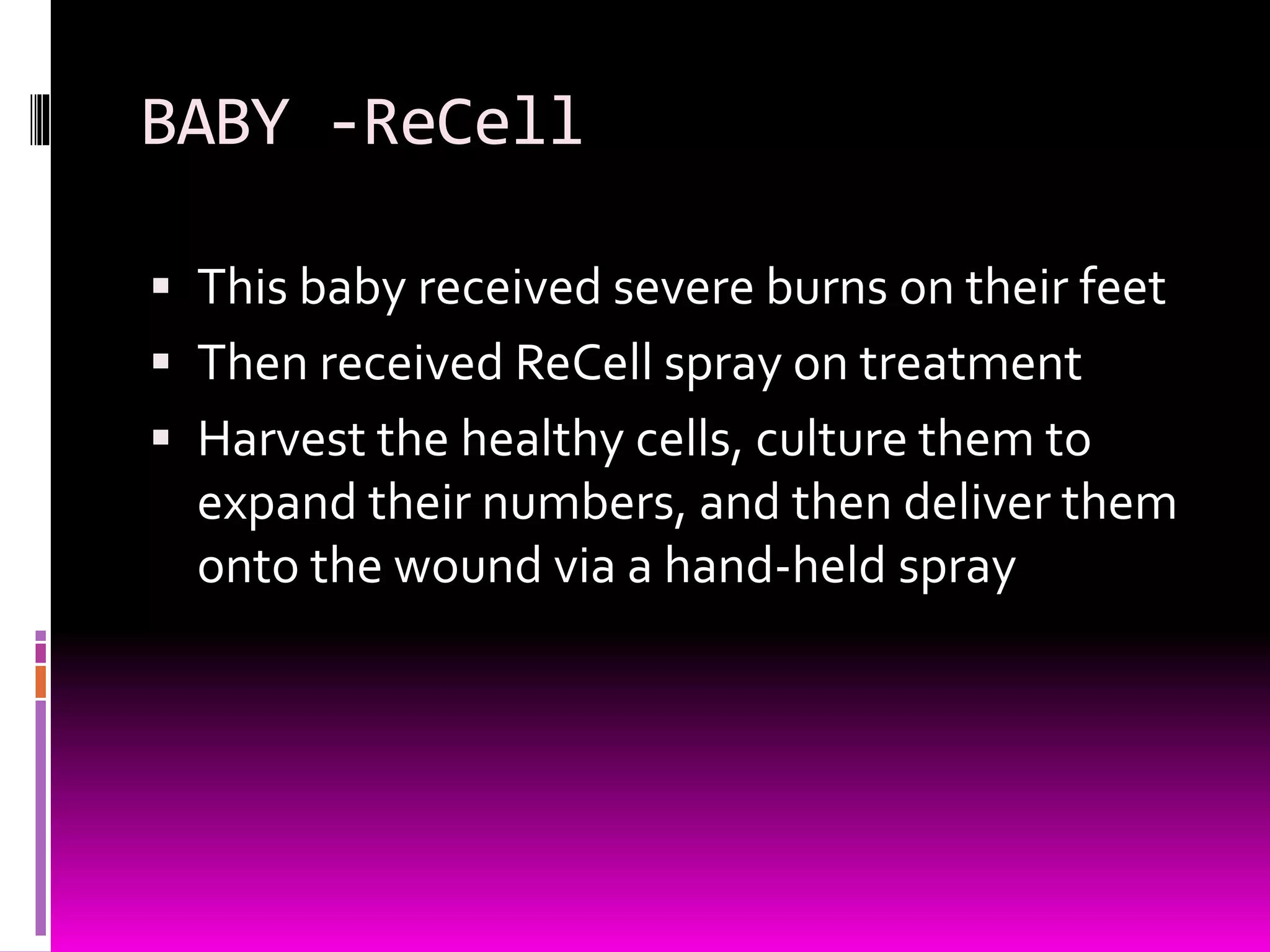 Burns - Before and After | PPTX