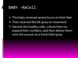 Burns - Before and After | PPTX