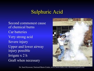 Burns- chemical and pediatric by Dr. Sunil Keswani, National Burns ...