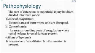 burns-classification- surgery mbbs third year | PPTX