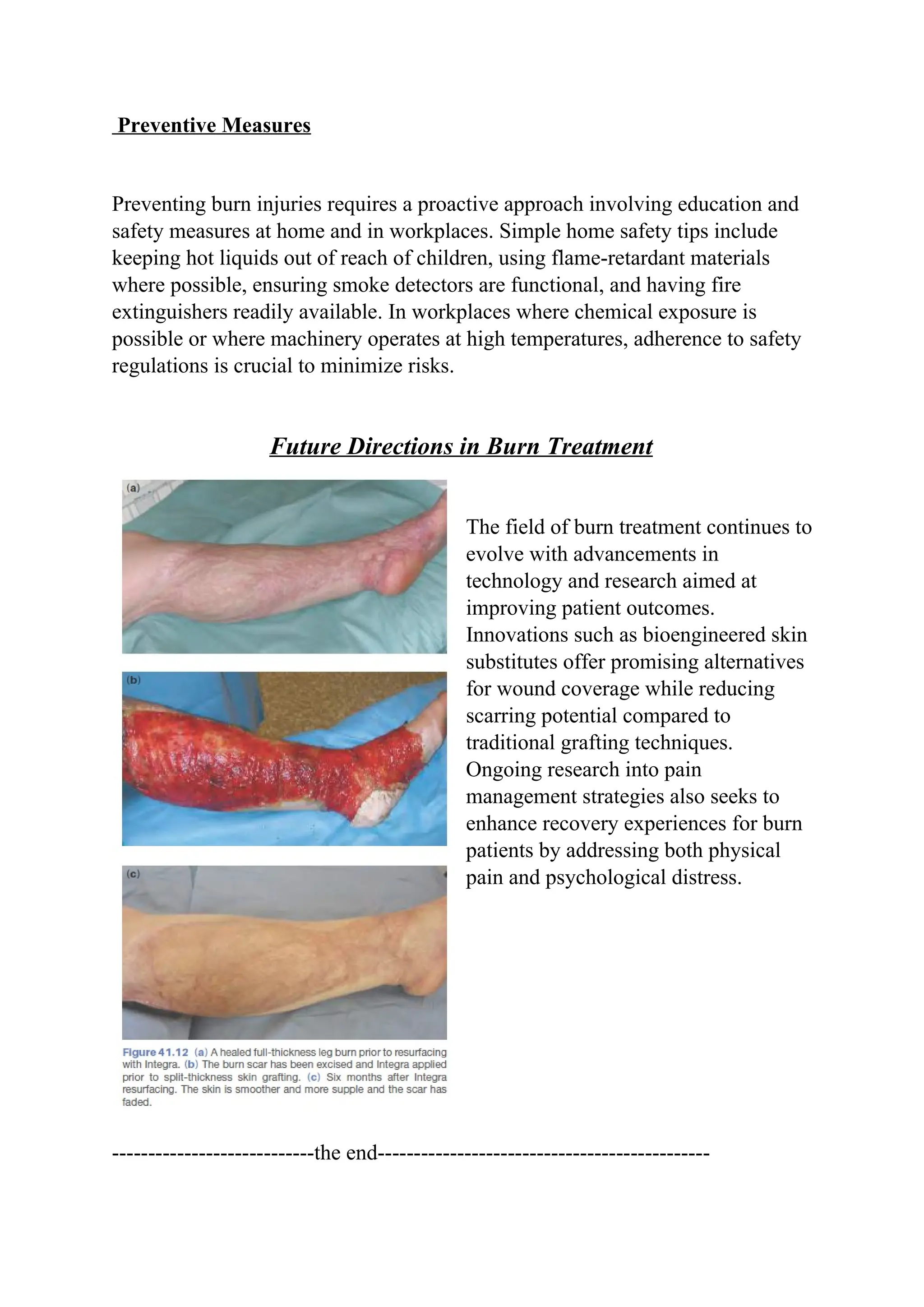 Burns -definations, types, causes, complications, degreee of burns, and ...