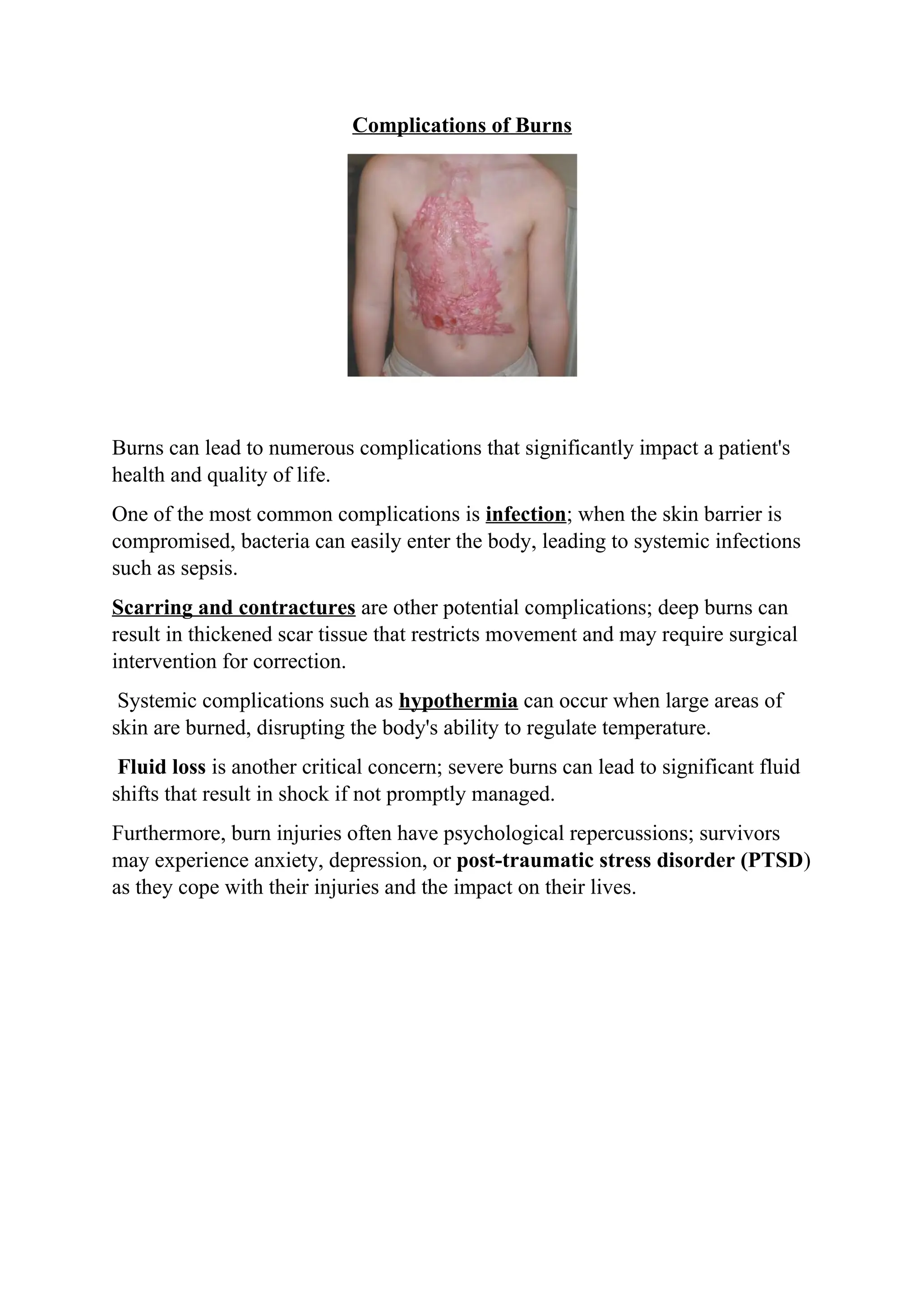 Burns -definations, types, causes, complications, degreee of burns, and ...