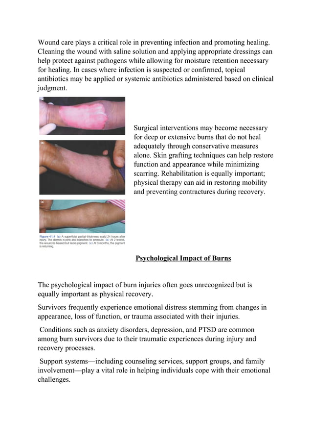 Burns -definations, types, causes, complications, degreee of burns, and ...
