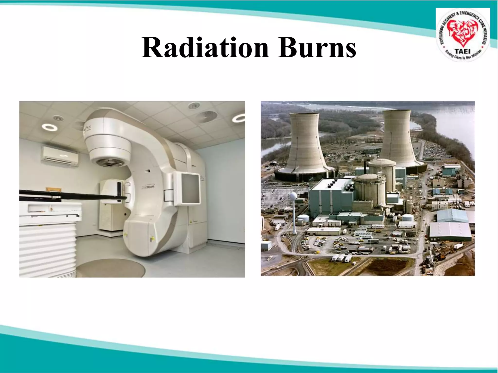 Burns-Original.pptx | First Aid | Injuries
