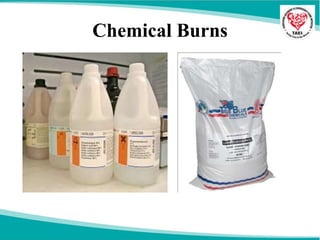 Burns-Original.pptx