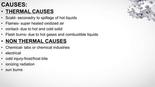 burns.pptx | Skin and Dermatology | Diseases and Conditions