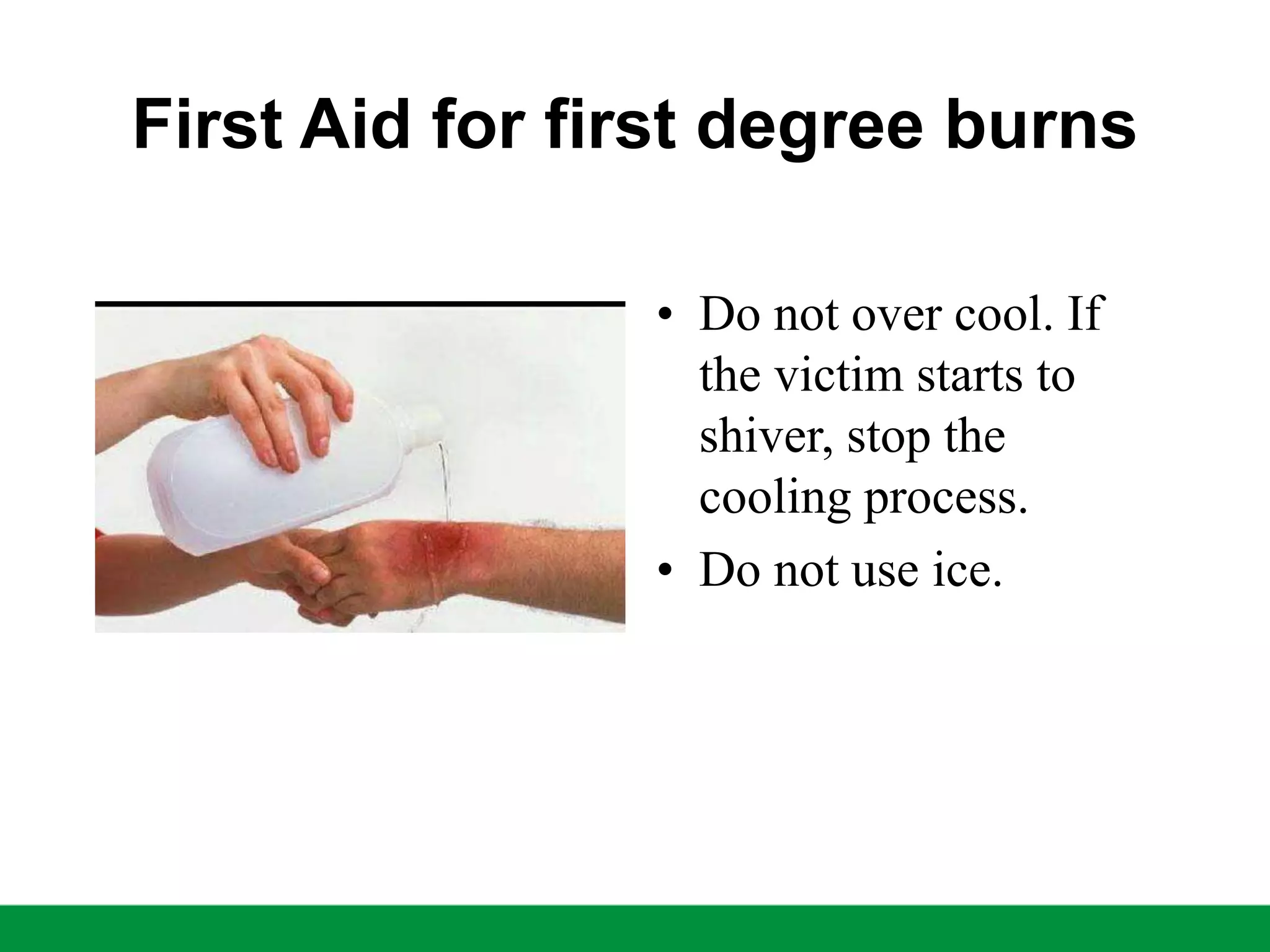 First aid in burns | PPTX