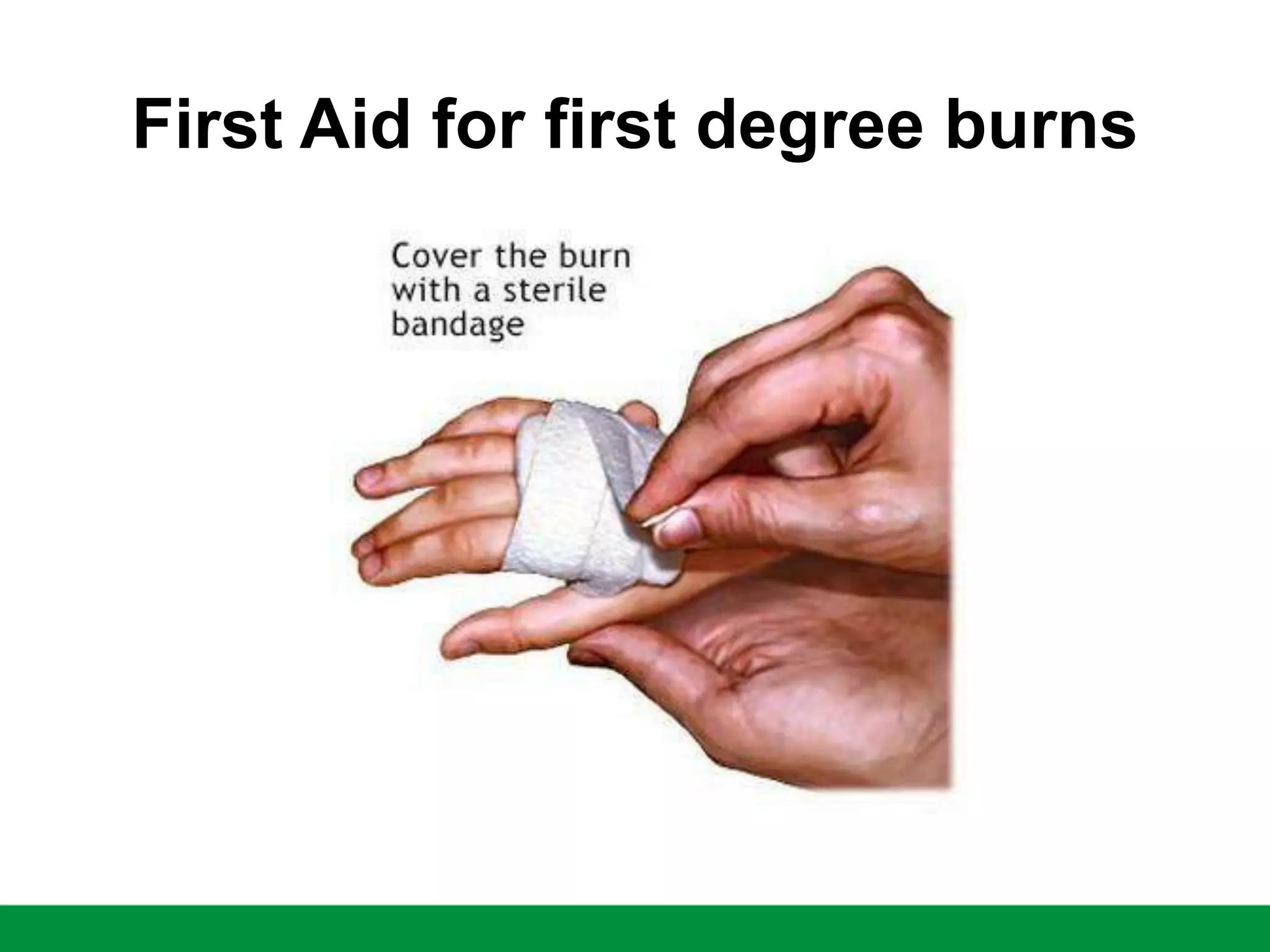 First aid in burns | PPTX