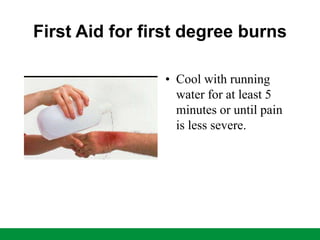 First aid in burns | PPTX