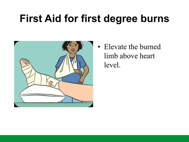 First aid in burns | PPTX | First Aid | Injuries