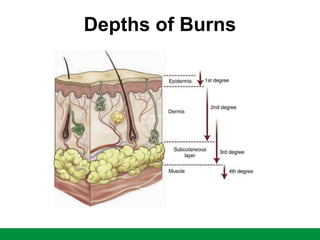 First aid in burns | PPTX