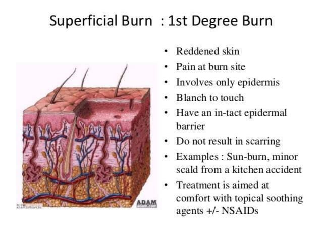 Burn | PPTX | Death, Injury, or Military Conflict | Sensitive Topics