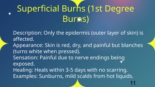 Burns and Burn Diseases how to treat burns.pptx