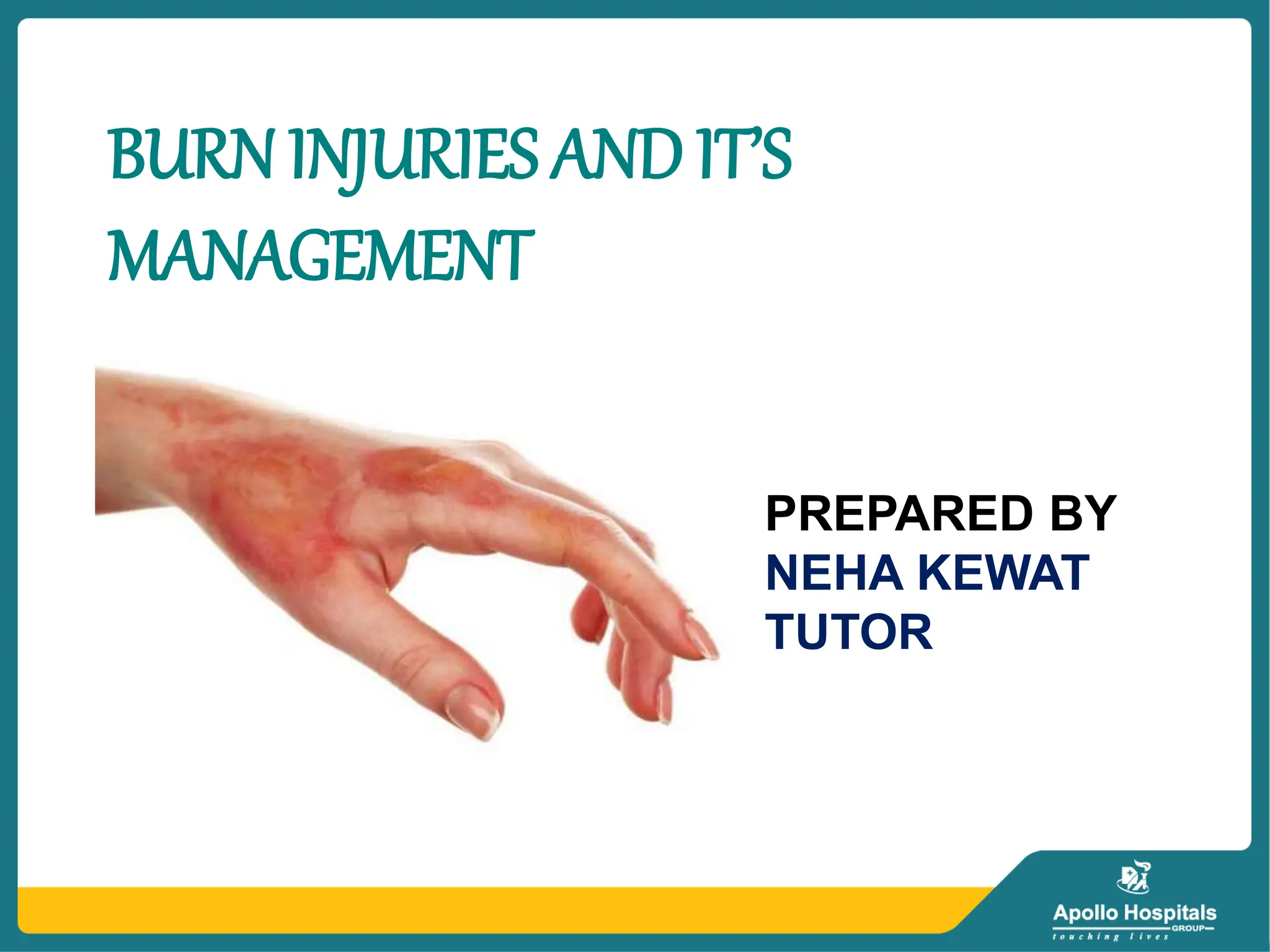 BURNS AND ITS MANAGEMENT.pptx PREPARED BY NEHA KEWAT | PPTX