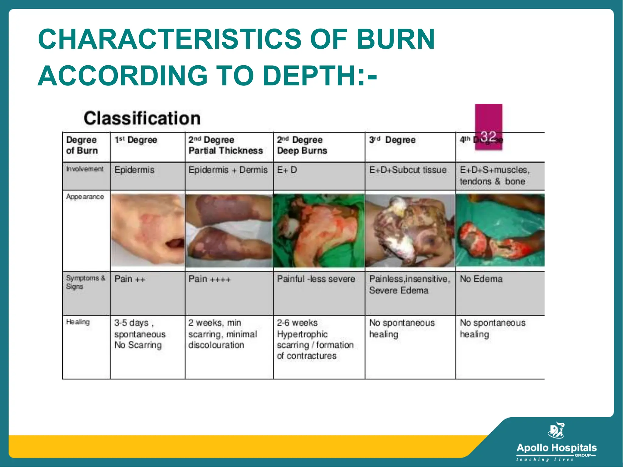 BURNS AND ITS MANAGEMENT.pptx PREPARED BY NEHA KEWAT | PPTX