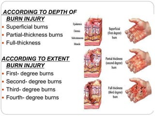 Burns and scalds | PPT