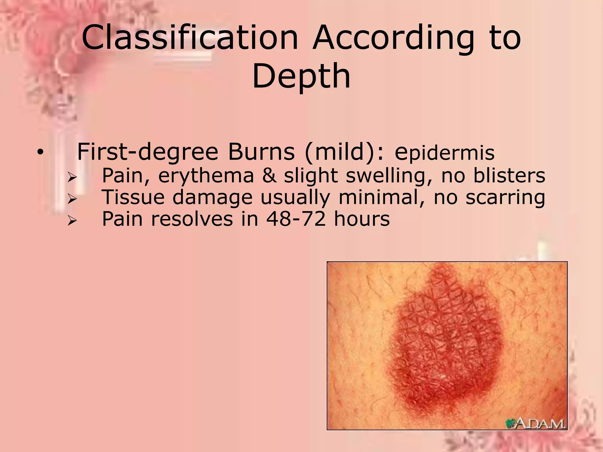 Nursing management of Burns | PPTX