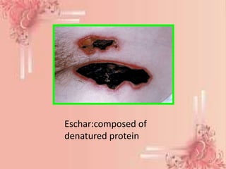 Nursing management of Burns | PPTX