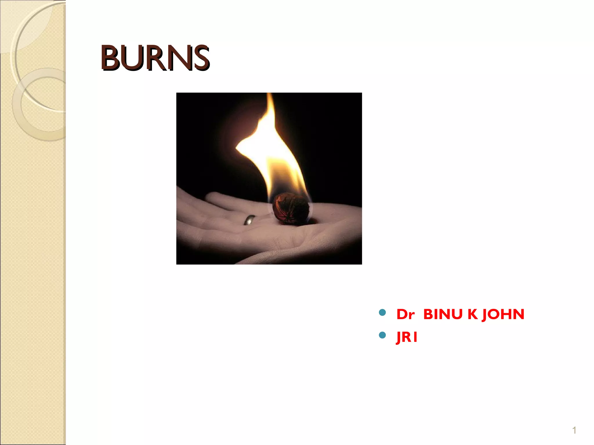 Burns | PPT