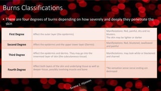 Burns; Types, Management, Treatment and Causes | PPT