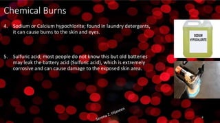 Burns; Types, Management, Treatment and Causes | PPT