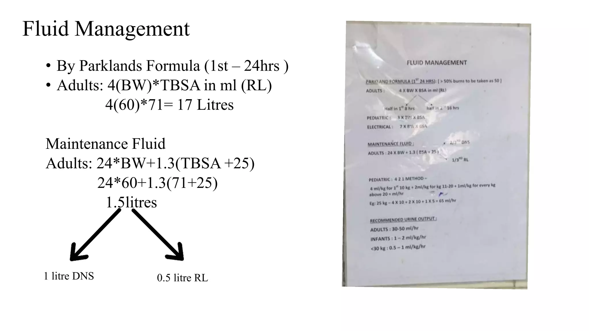 CASE STUDY ON BURNS | PPTX