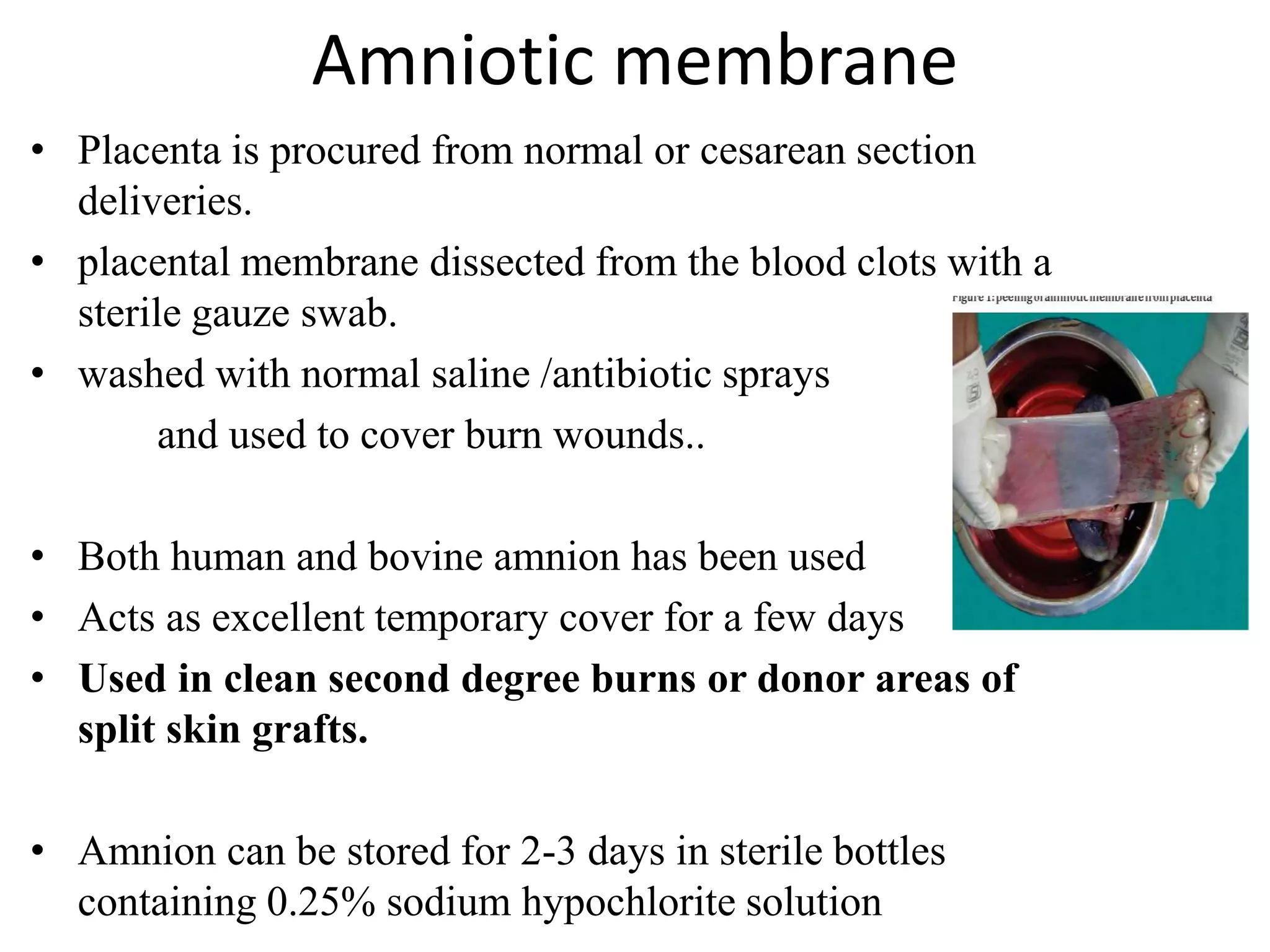 Burns dressings.pptx