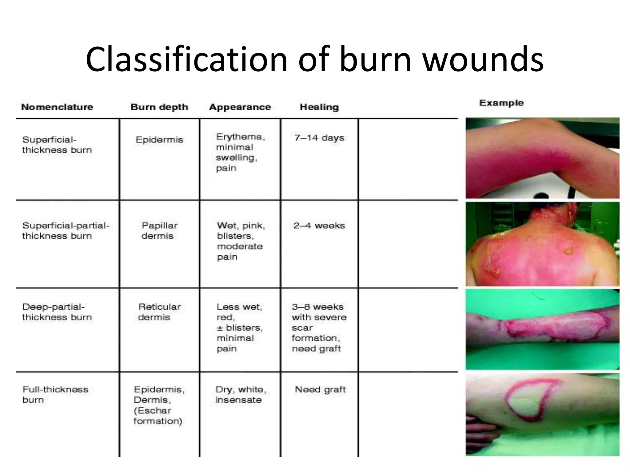 Burns dressings.pptx